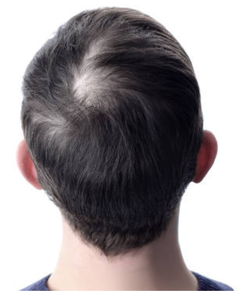 Aloha Care -Shampoo Anticaída Capilar