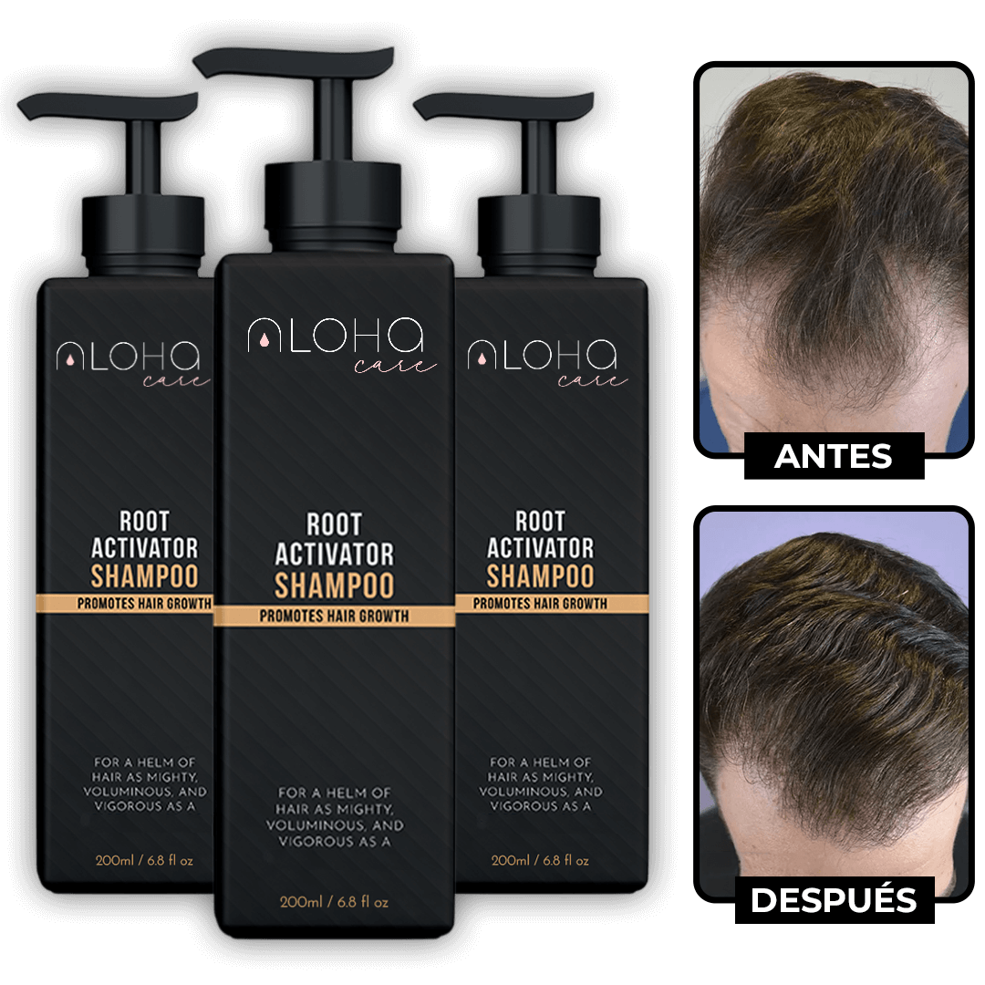 Aloha Care -Shampoo Anticaída Capilar